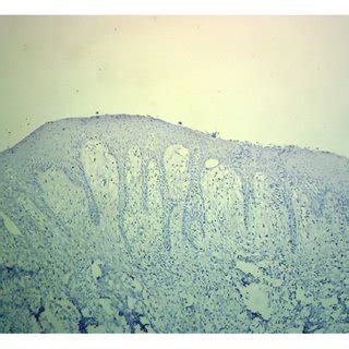 Representative Photomicrographs Of The Immunohistochemical Staining For