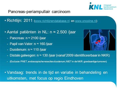 Pancreas Periampulair Carcinoom In Beeld Regio Eindhoven Ppt Video