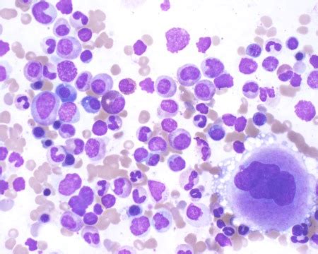 Hematology Media Labs Exam Ch Flashcards Quizlet