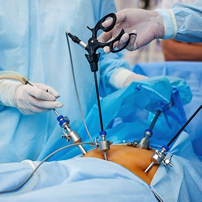 Liver Surgical Conditions Oxford Gallstone Clinic