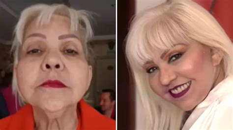 El cambio de la Gorda Fabiola tras someterse a una cirugía
