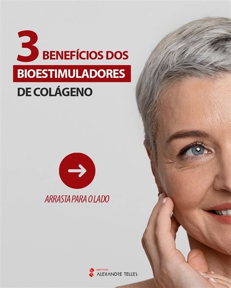 Dr Alexandre Telles on Instagram 3 BENEFÍCIOS dos Bioestimuladores