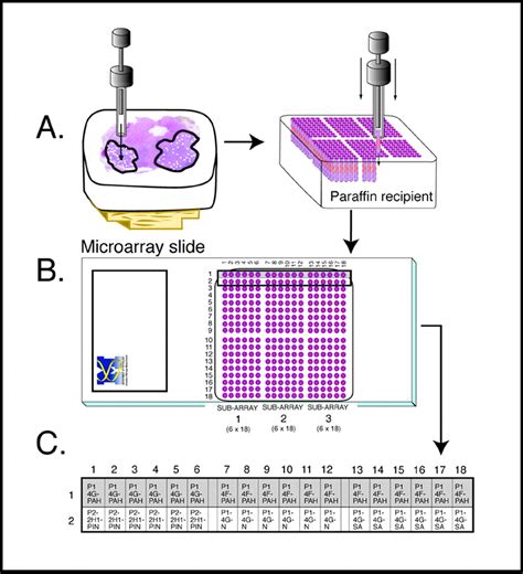 Relational Database Structure To Manage High Density Tissue Microarray