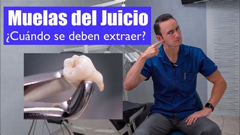 C Mo Saber Si Una Muela Del Juicio Est Saliendo Bien Gu A Completa