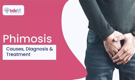 Phimosis Causes Diagnosis Treatment India Ivf
