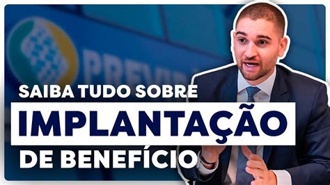 Implantação de benefício o que é e quanto tempo demora Clientes