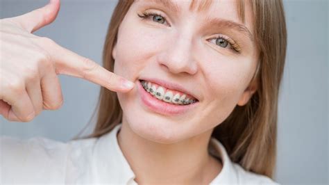 Aparelho odontológico qual a função tipos e valores Clinica OralDents