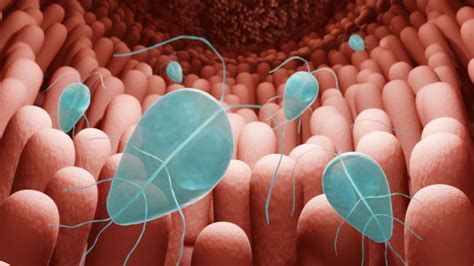 Infectia Cu Giardia La Adulti Si La Copii Cauze Tratament Preventie