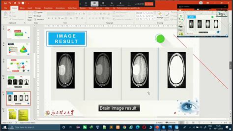 Medical Image Processing Using Matlab Abdullah Al Foysal Digital