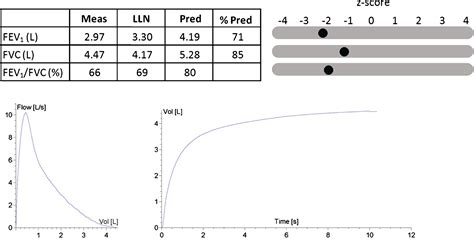 Difference Between Spirometry For Asthma And Spirometry 48 OFF