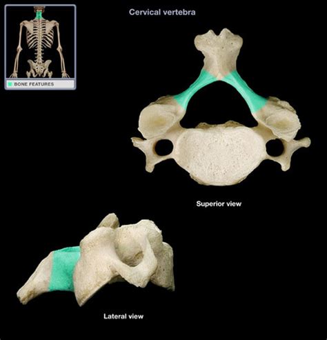 Bones Bony Prominence Of The Spine And Thorax Flashcards Quizlet