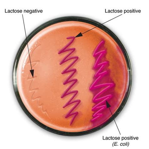 Microbiology Lab Final Exam Flashcards Quizlet