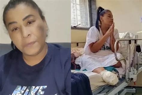 MC Kátia pede ajuda após amputar a perna devido a uma trombose