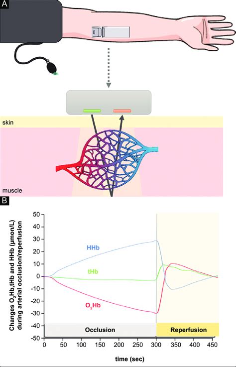 Evaluation Of Muscle Oxygenation Via Near Infrared Spectroscopy NIRS