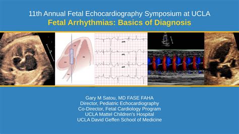 PDF Fetal Arrhythmias Basics Of Diagnosis DOKUMEN TIPS