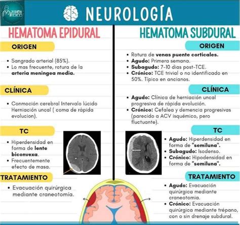 Hematoma Epidural Y Hematoma Subdural Yudoc Org Udocz