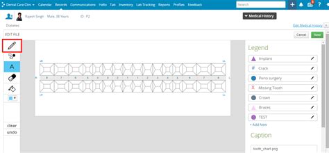 Blank Dental Chart Template