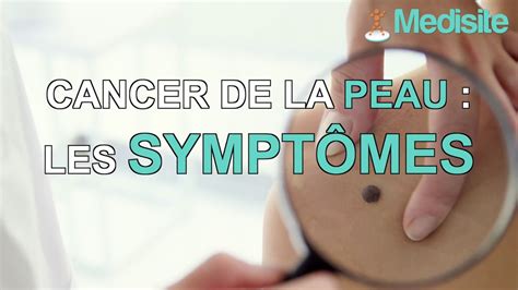 Cancer de la peau les symptômes qui doivent alerter Vidéo Dailymotion