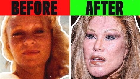 10 People Who Took Plastic Surgery TOO Far YouTube