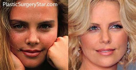 Charlize Theron Took The Absolute Best Possible Approach To Plastic