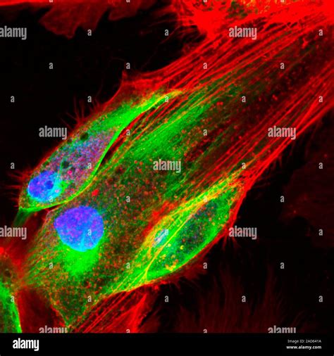 Fibroblast Skin Cells Fluorescence Light Micrograph Of Fibroblast