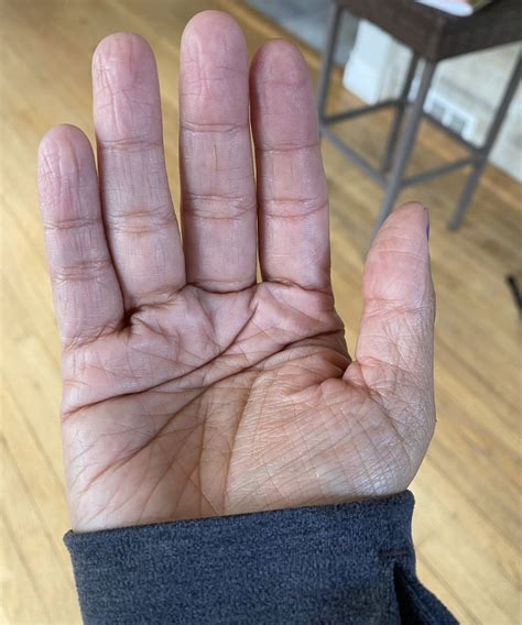 Daria Oller Pt Dpt Atc On Twitter My Fingers Still Look Like