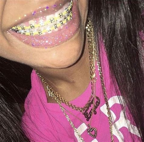 Brace Face Brace Face Braces Teeth Colors Cute Braces