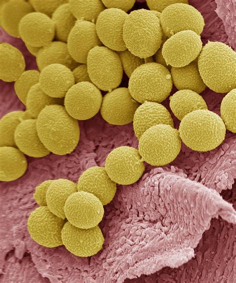 Athlete S Foot Fungus Sem Photograph By Steve Gschmeissner Pixels