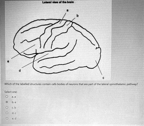 SOLVED Tr Met 0l The Brain Which Of The Labelled Structures Contain