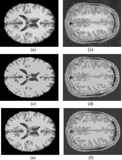 figure 4 from a variational model of multiphase segmentation for images with gaussian noises and