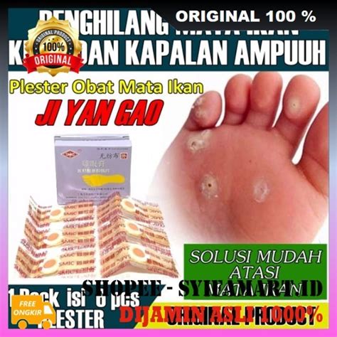 Jual Obat Mata Ikan Di Telapak Kaki Ampuh Ji Yan Gao Isi 6 Plester