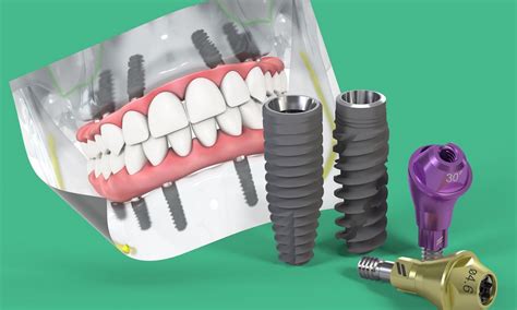 Por Que S Utilizamos Os Implantes Dent Rios Da Straumann