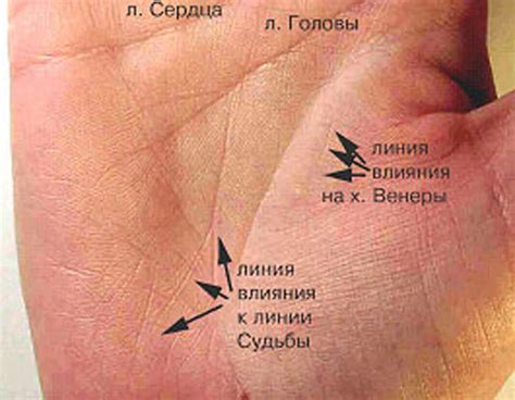 Как определить по руке заболевание печени фото презентация