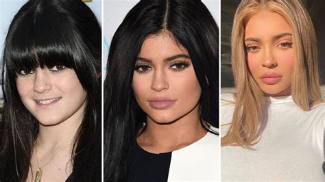 Kylie Jenner Before And After Surgery Boobs Teeth Lips Photos