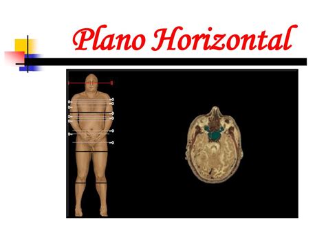 PPT ANATOMÍA TOPOGRÁFICA FORENSE PowerPoint Presentation free