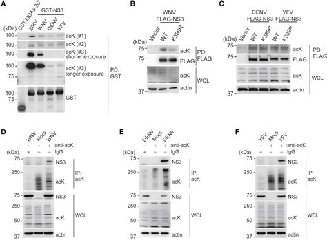 Acetylation of the NS3 helicase by KAT5γ is essential for flavivirus
