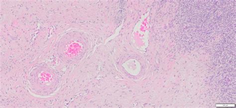 Human Ovary Normal FFPE Sections