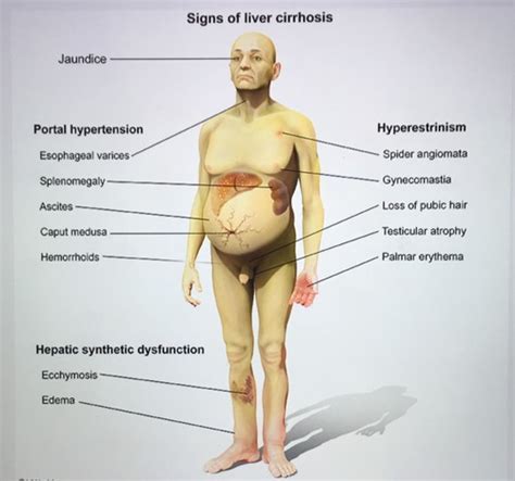 Abdominal Assessment Flashcards Quizlet