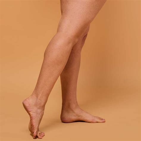 Entendendo o Lipedema Causas Sintomas e Diagnóstico Dra Xênia Portella