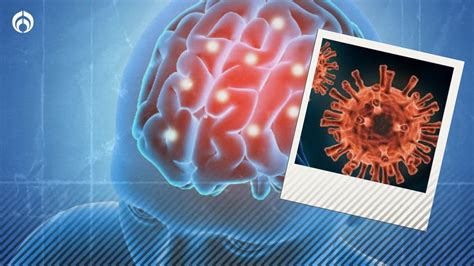 Meningitis Aséptica Te decimos los síntomas de alerta de esta