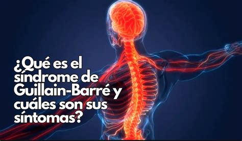 Qu Es El S Ndrome De Guillain Barr Y Cu Les Son Sus S Ntomas