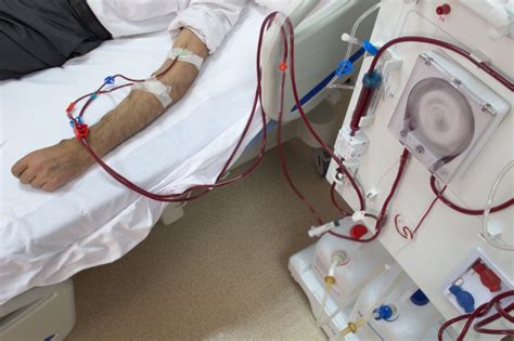 Hemodiálise entenda esse procedimento khondrion