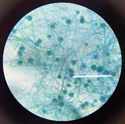 Food Micro Lab Yeast Mold Flashcards Quizlet