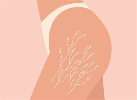 Faites La Peau La Cellulite Les Solutions Naturelles