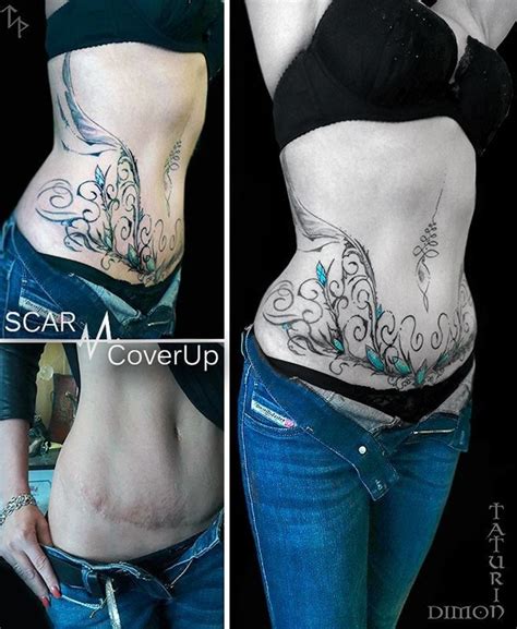 Pin By MJ LifeAblaze On Tattoo Ideas Scars Tattoo Cover Up Tattoos