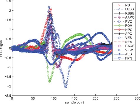figure 1 from ecg signal classification using support vector machine based on wavelet