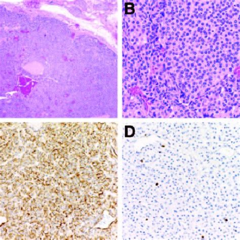 A Hematoxylin And Eosin H E Staining At Low Power Shows