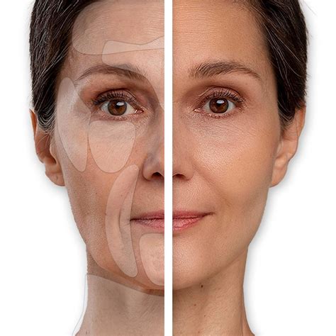 Amazon REUSABLE Forehead Wrinkle Patches Wrinkle Patches