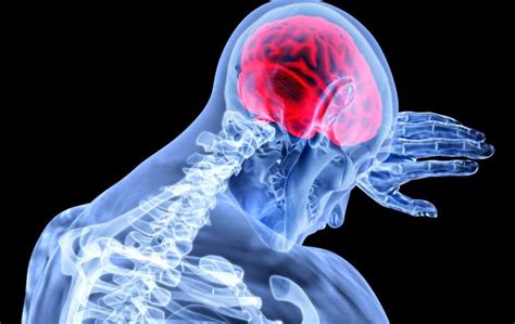 Encefalitis Causas síntomas y tratamiento