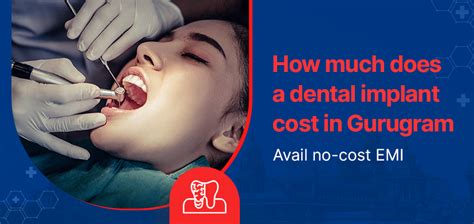 How Much Does A Dental Implant Cost In Gurugram Avail No Cost EMI